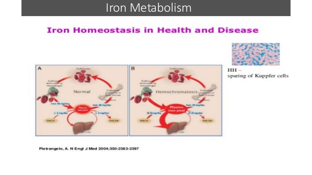 Metabolism of iron and its clinical significance