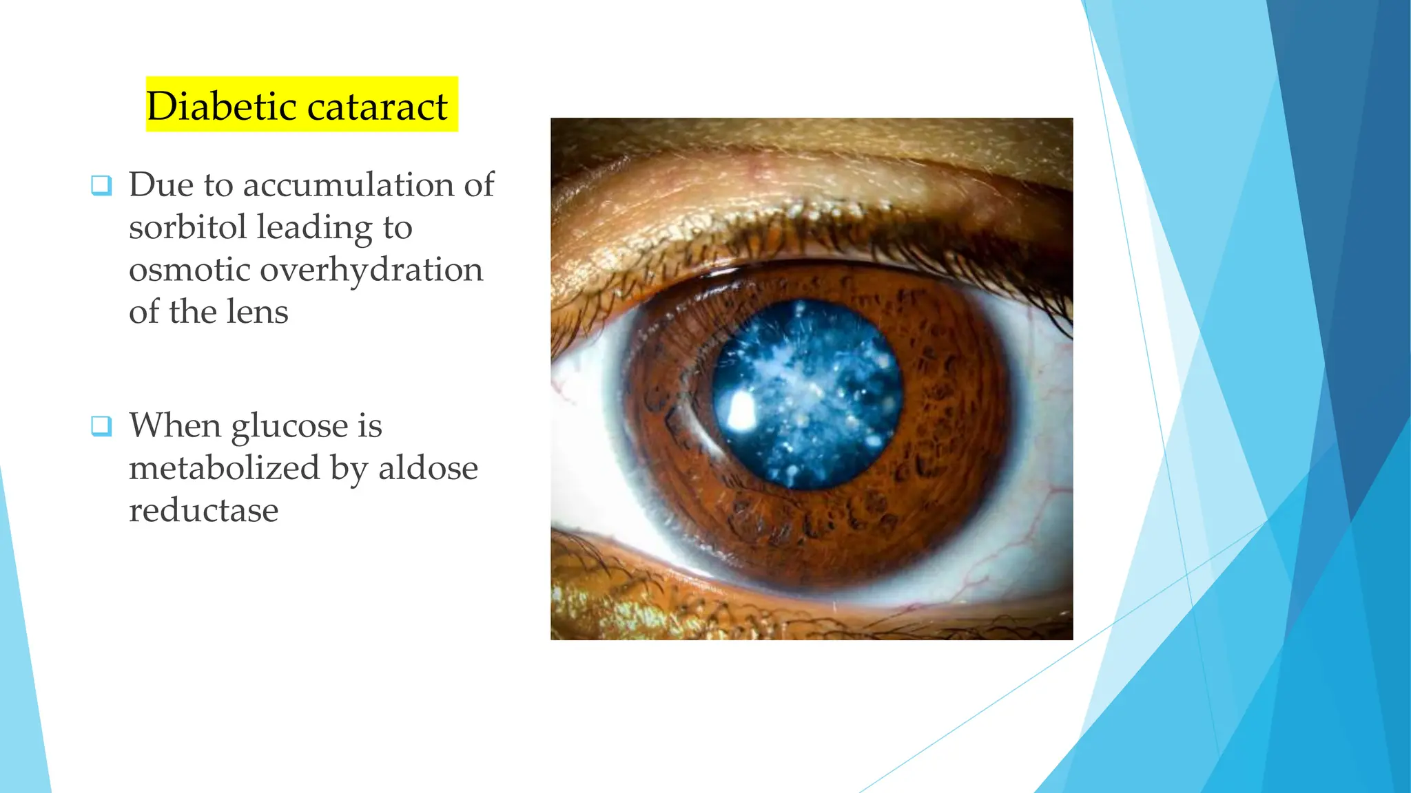 METABOLISM OF LENS of human eye. Ophthalmology | PPTX