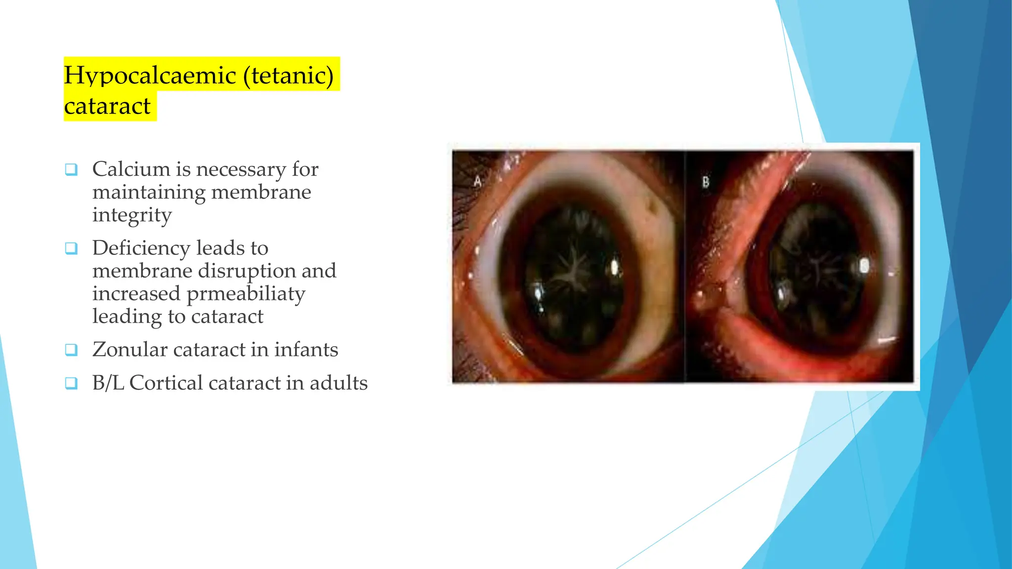 METABOLISM OF LENS of human eye. Ophthalmology | PPTX