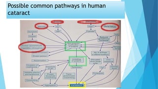 METABOLISM OF LENS of human eye. Ophthalmology | PPTX