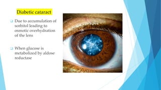 METABOLISM OF LENS of human eye. Ophthalmology | PPTX