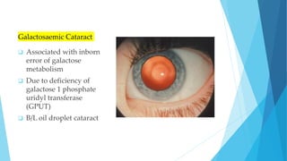METABOLISM OF LENS of human eye. Ophthalmology | PPTX