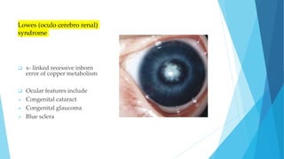 METABOLISM OF LENS of human eye. Ophthalmology | PPTX