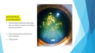 METABOLISM OF LENS of human eye. Ophthalmology | PPTX