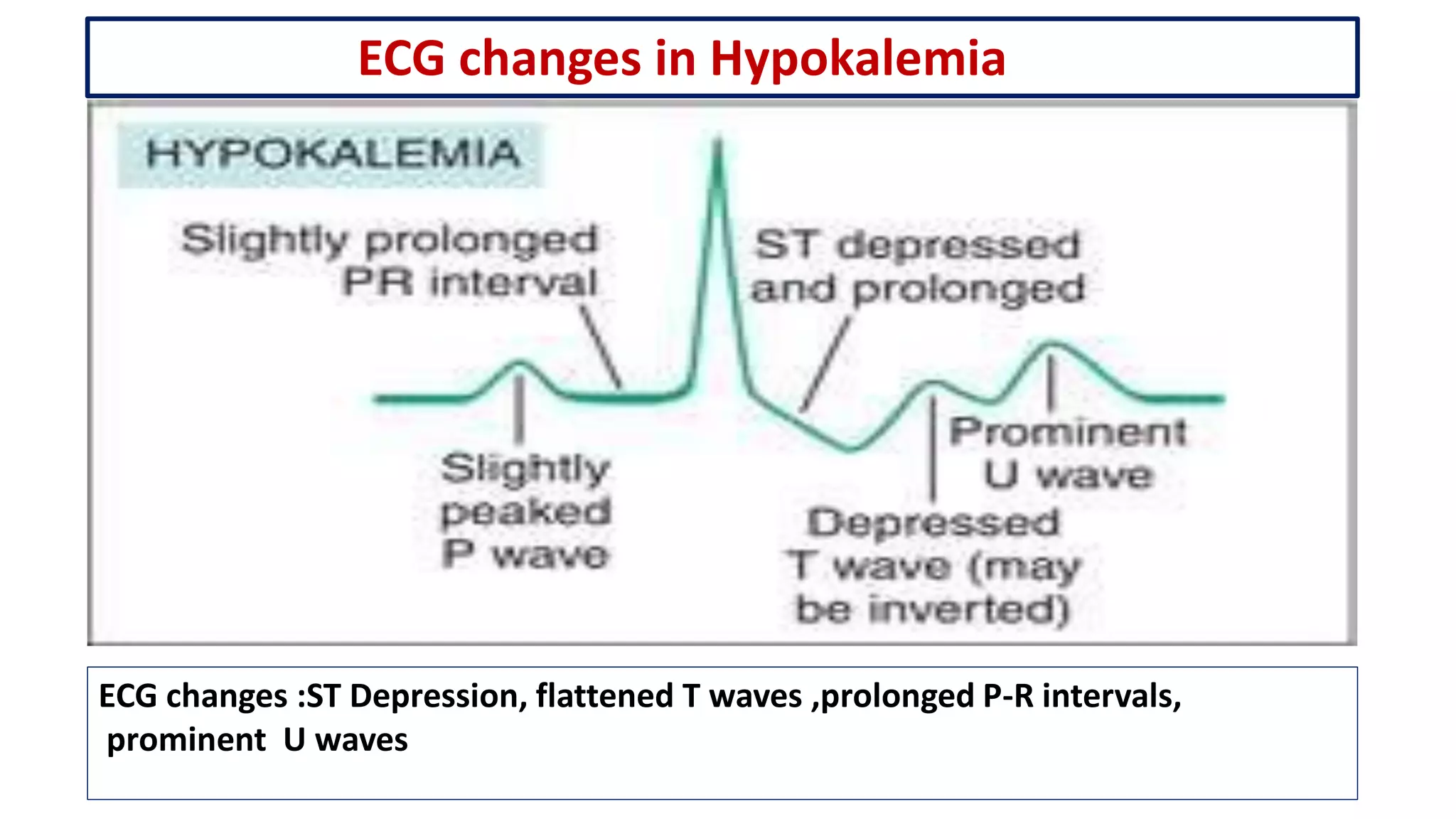 Metabolism of potassium and its clinical significance | PDF