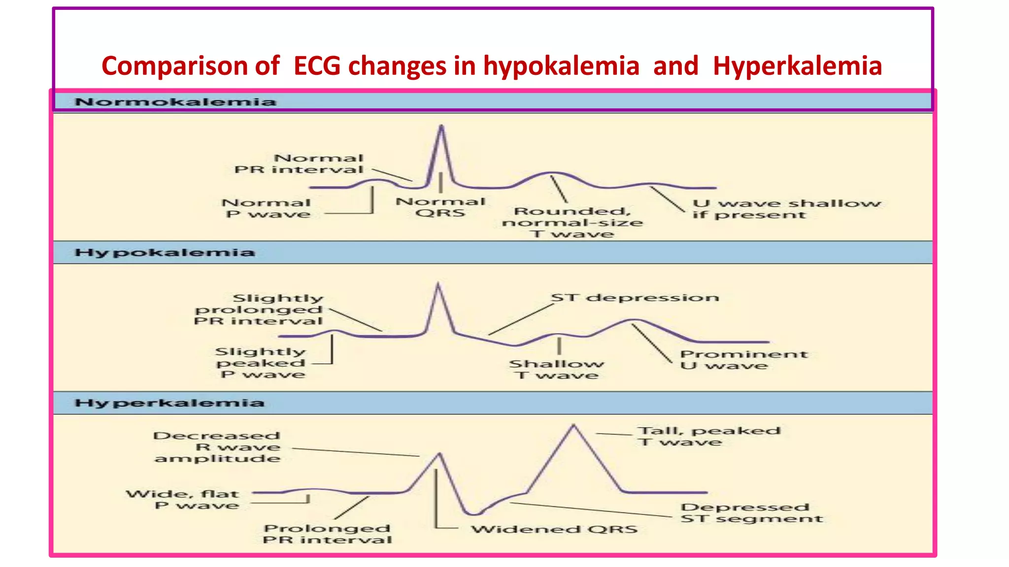 Metabolism of potassium and its clinical significance | PDF