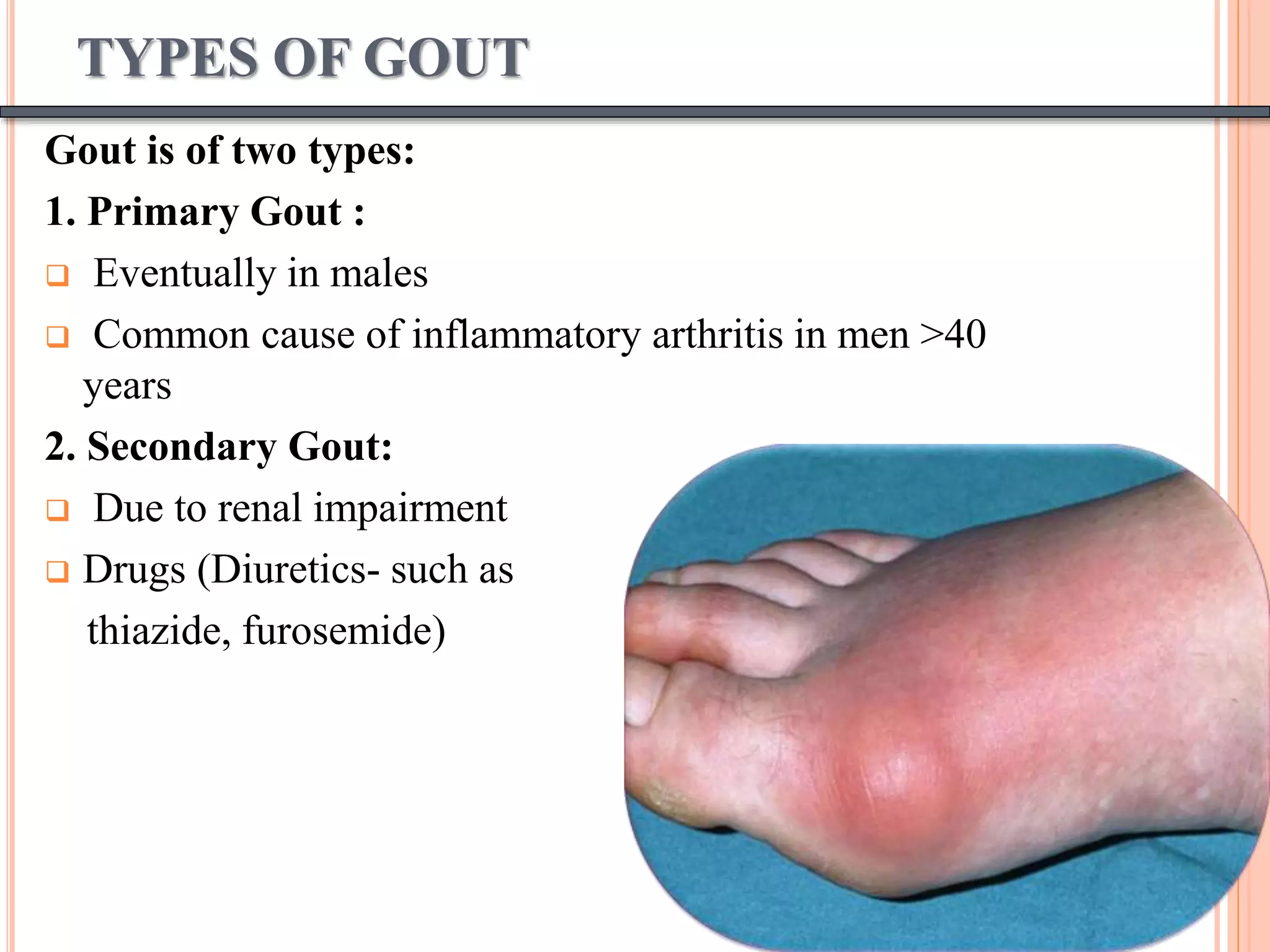 metabolism of purines and Gout.pptx