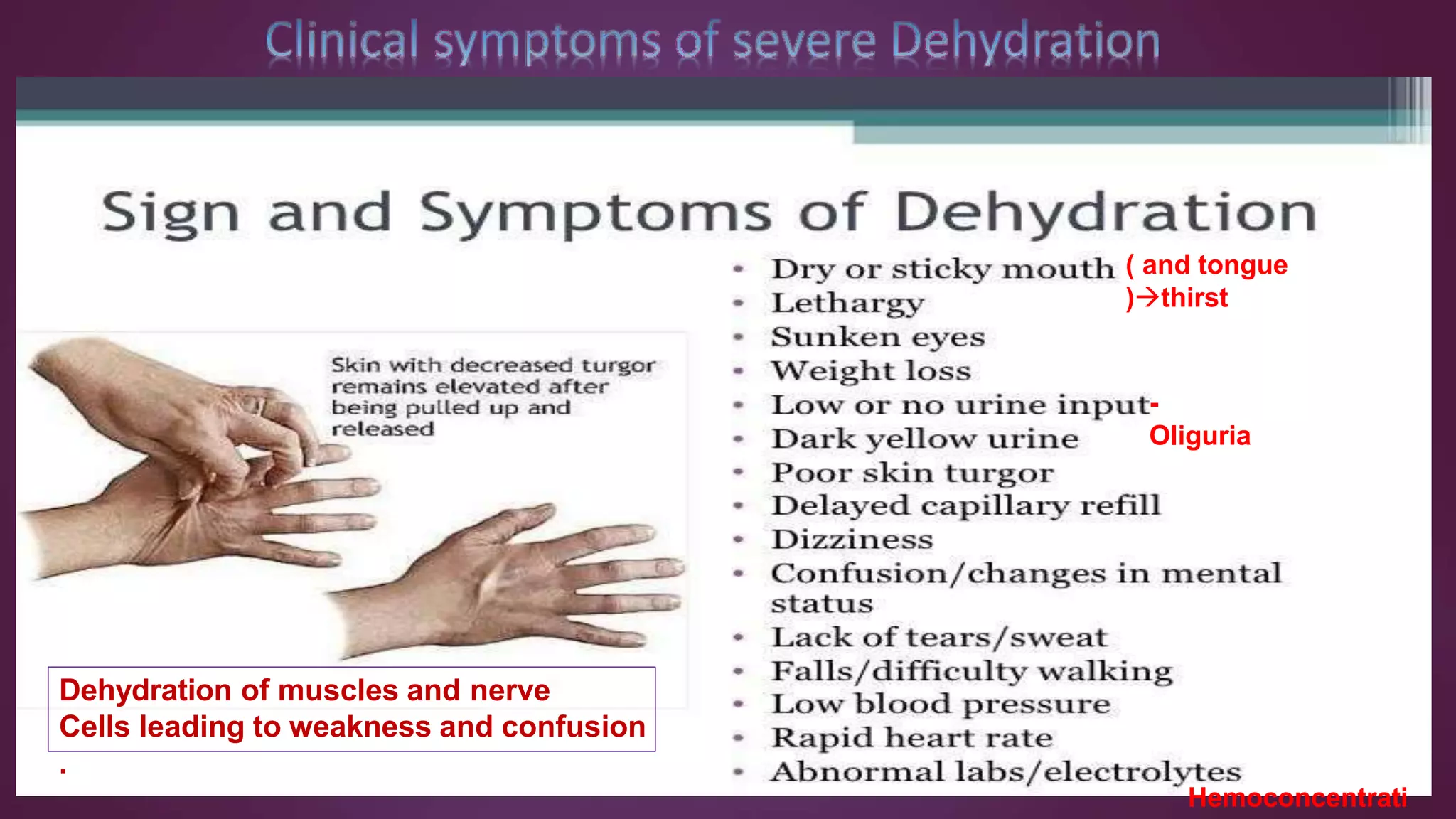 Metabolism of water and its clinical significance | PPTX