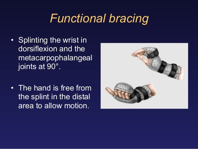 Metacarpal fractures Metacarpal fractures
