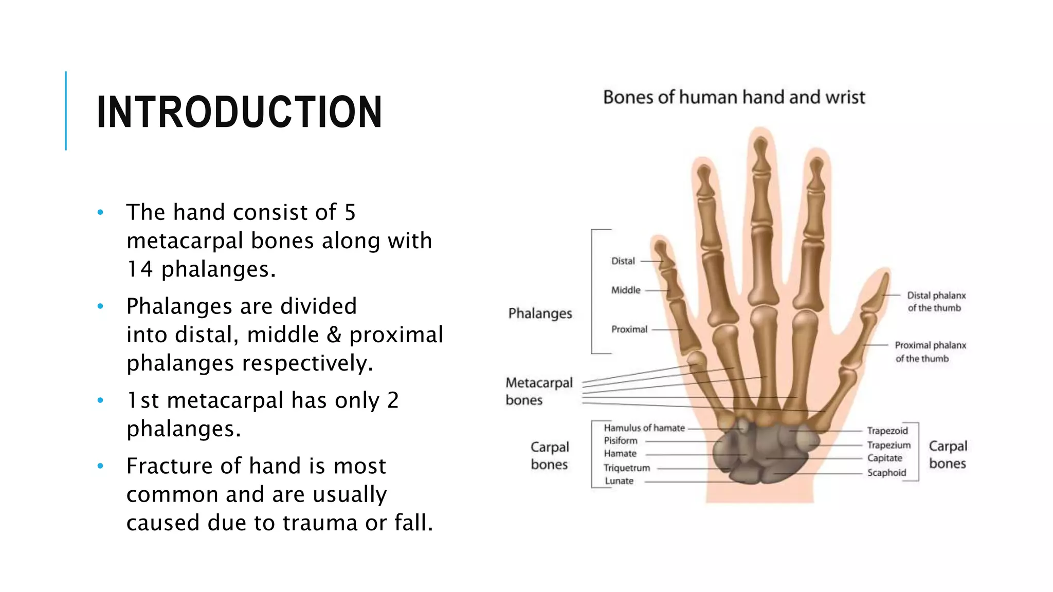 metacarpals & phalanges fractures.pptx
