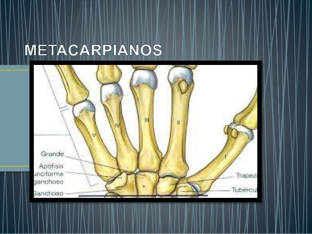 Huesos metacarpianos de la mano