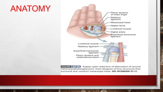 Metacarpo-phalyngeal joint dislocation.pptx