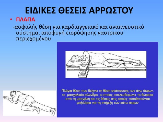 Ειδικές θέσεις ασθενών - μεταφορά ασθενών | PPTX
