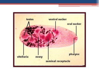 Metagonimiasis | PPSX