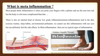 Obesity and metainflammation | PPTX