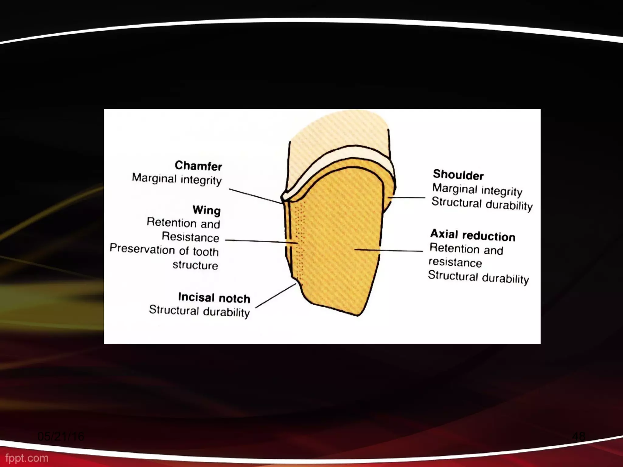 Tooth preparation for Metal ceramic crowns. | PPT | Dental Health ...