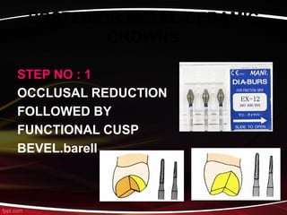 Tooth preparation for Metal ceramic crowns. | PPT