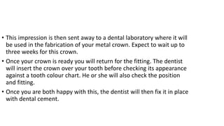 Metal ceramic crown | PPTX