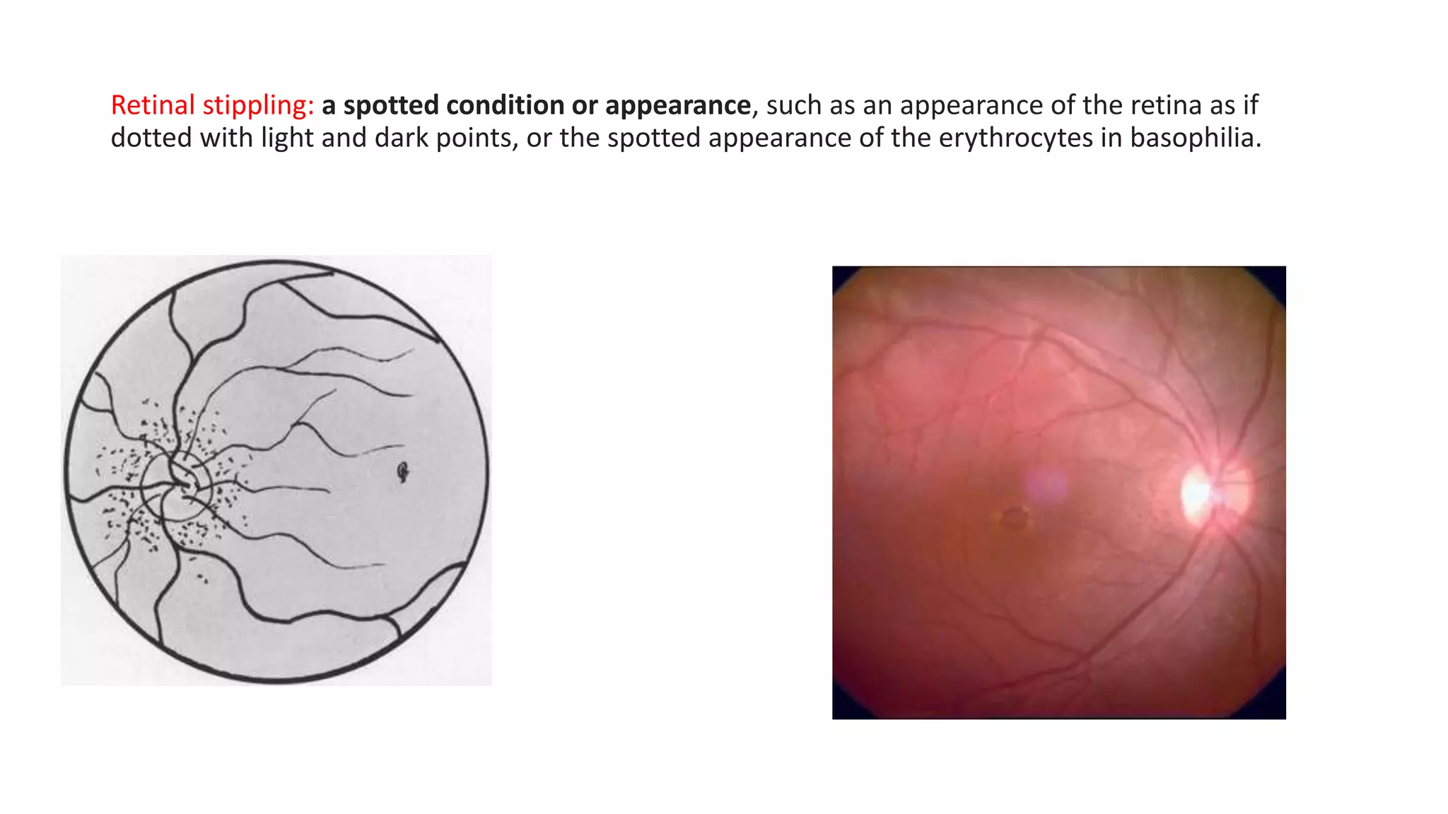 Metallic Poison.pptx