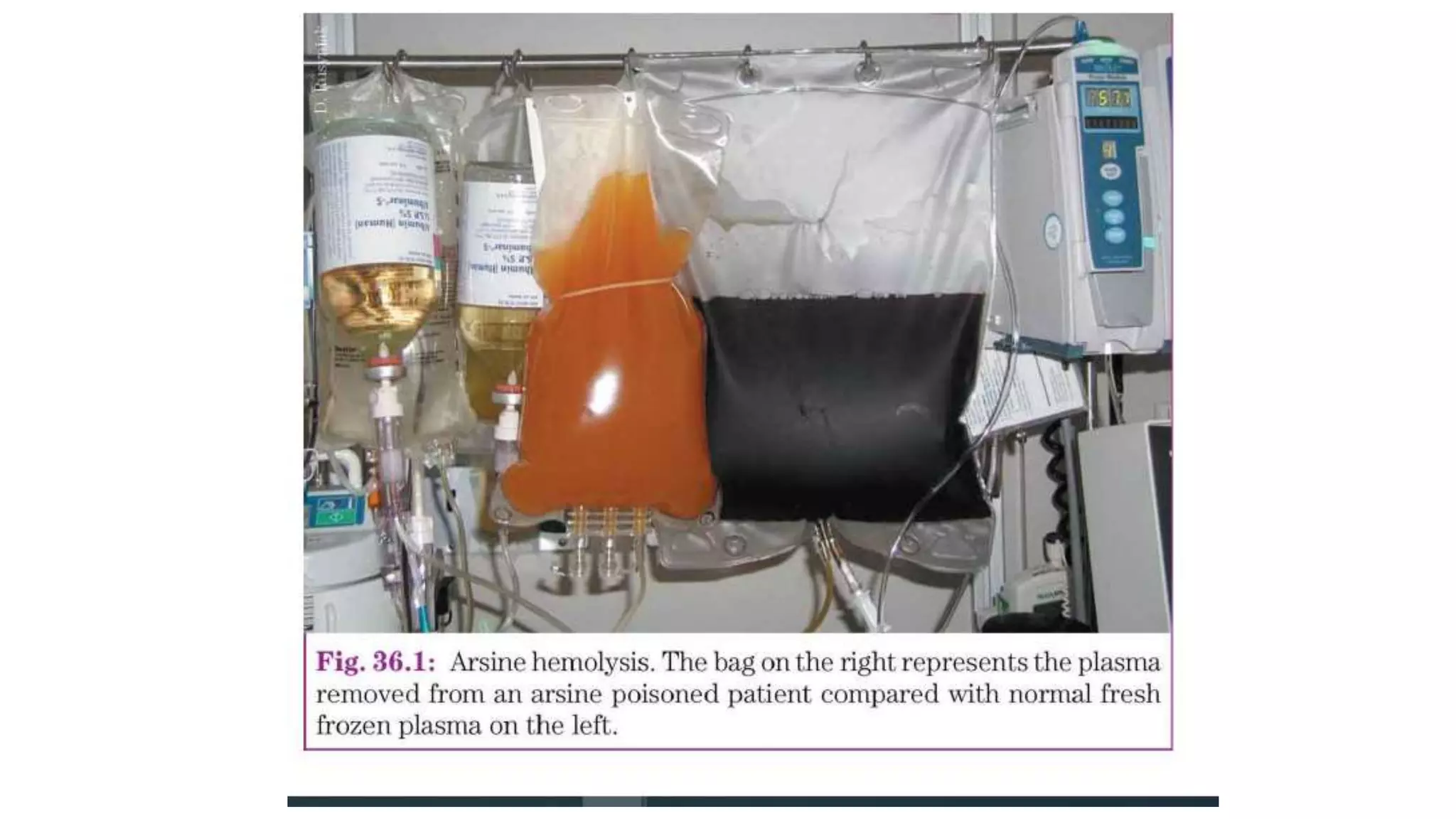 Metallic Poison.pptx