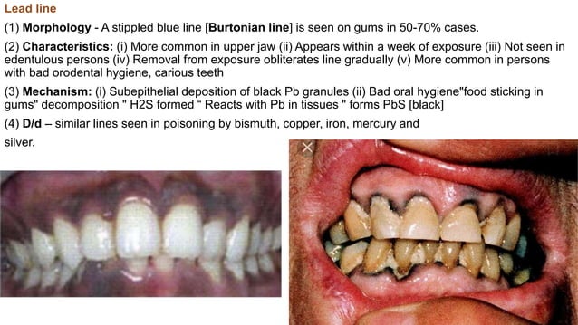 Metallic Poison.pptx