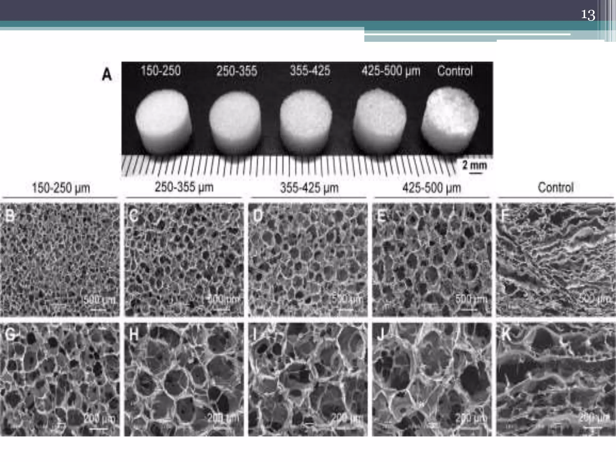 Metallic scaffolds for bone tissue engineering | PPTX