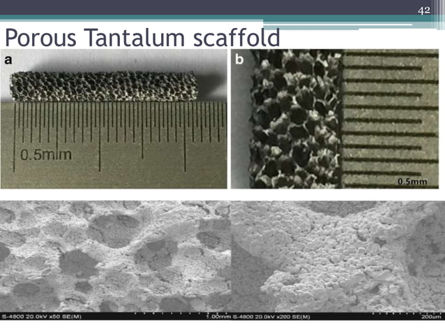 Metallic scaffolds for bone tissue engineering | PPTX