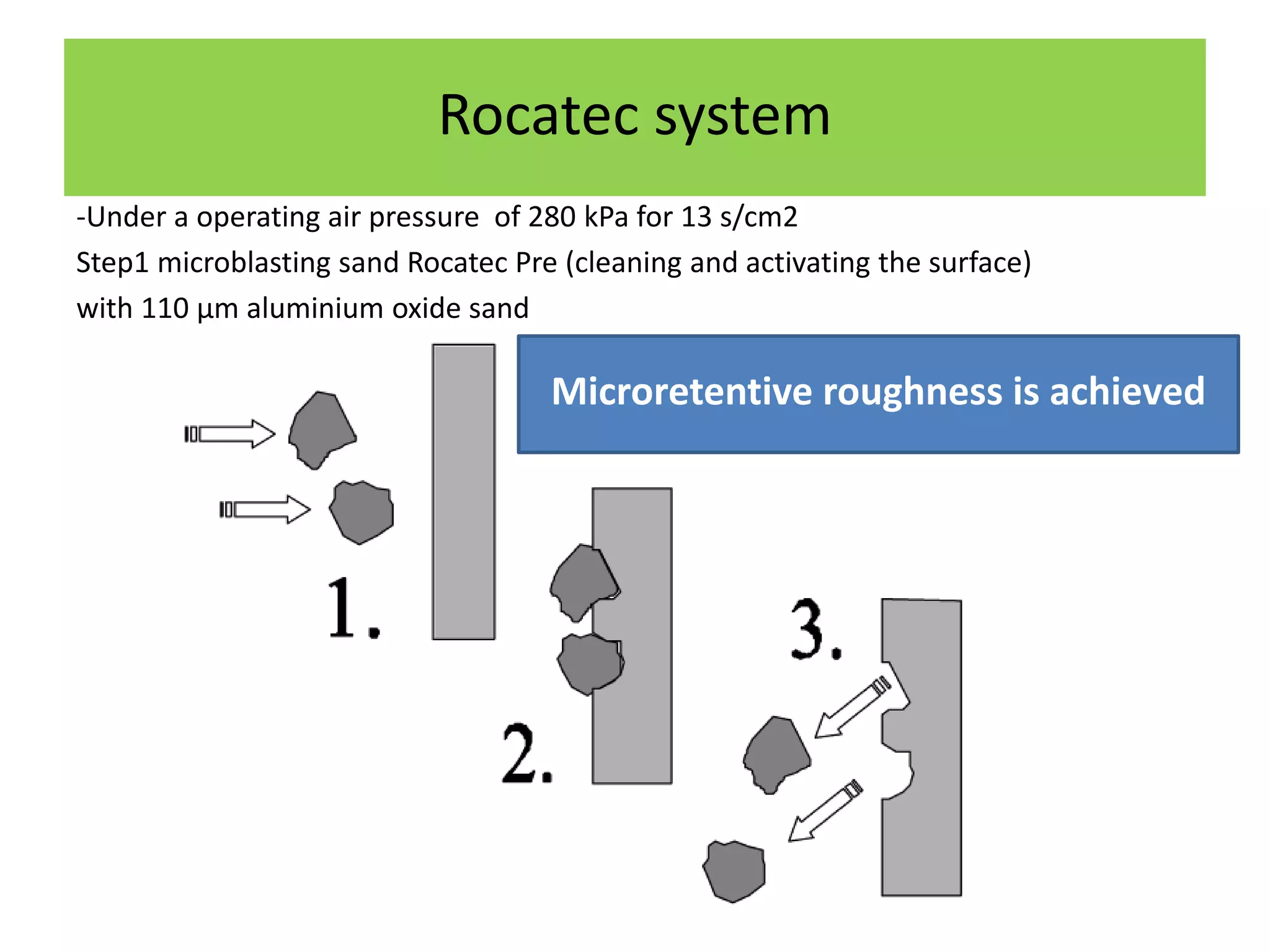 Metal primer ,silane,zirconia primer Reviews | PPTX