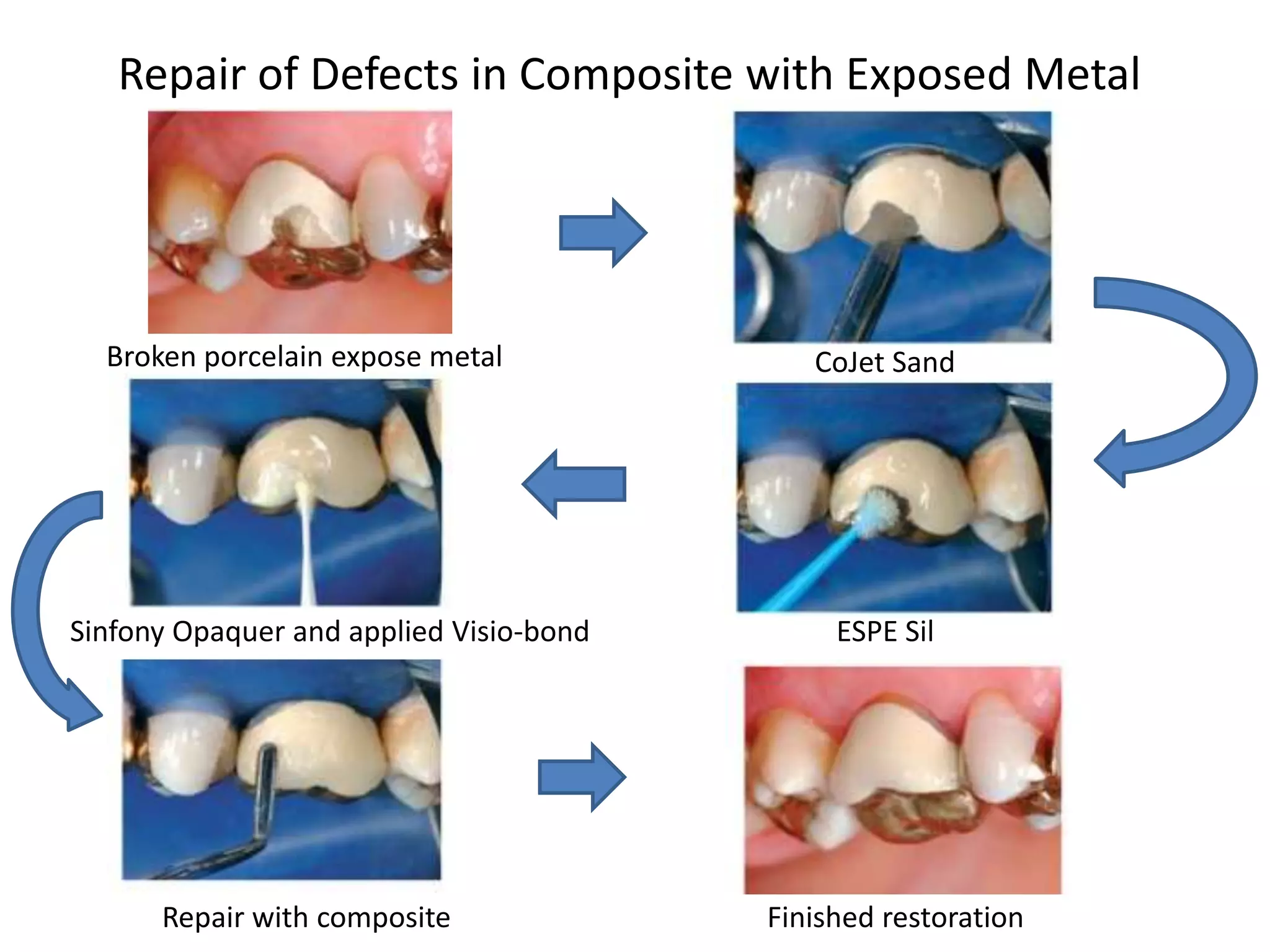 Metal primer ,silane,zirconia primer Reviews | PPTX