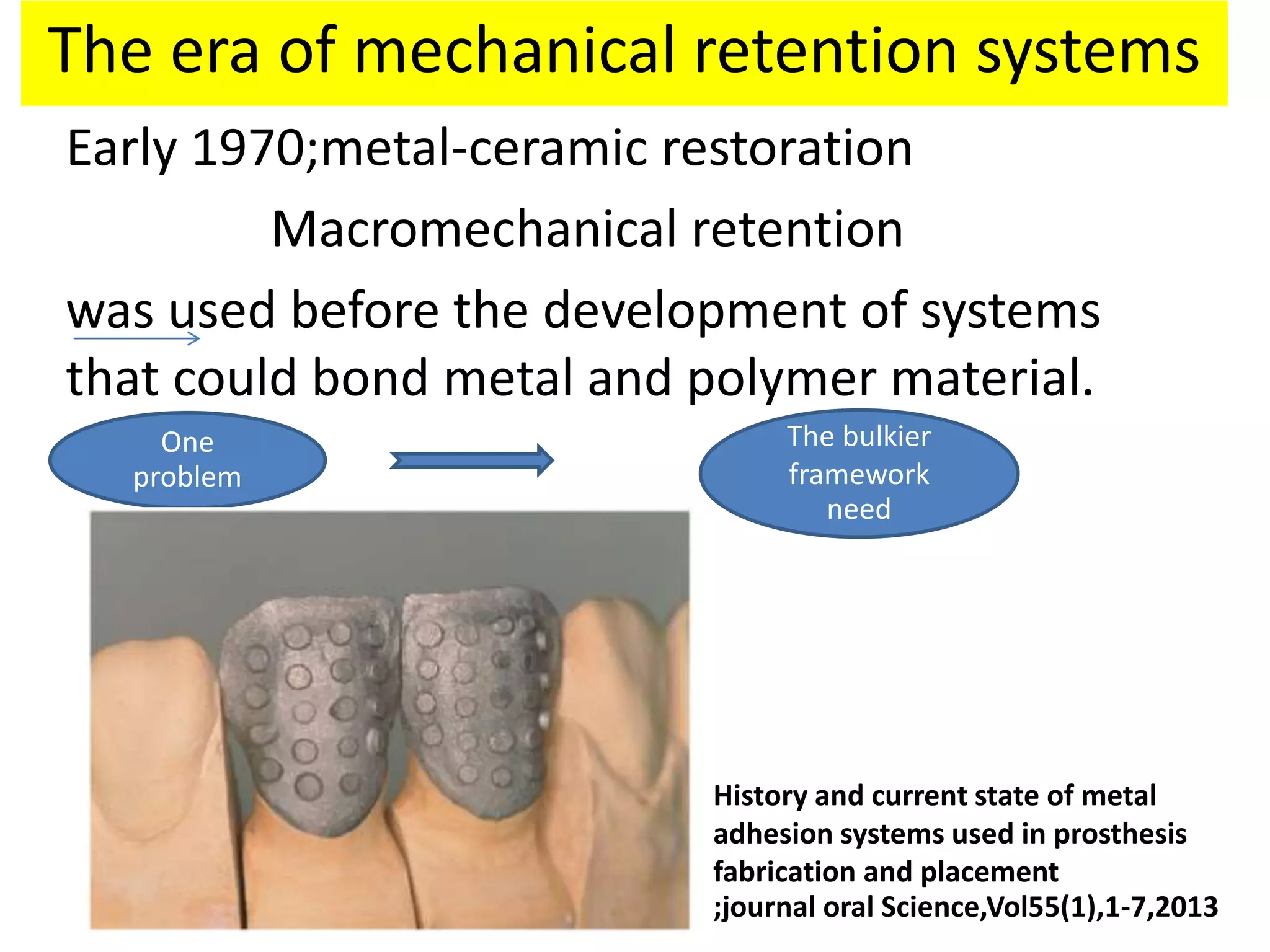Metal primer ,silane,zirconia primer Reviews | PPTX
