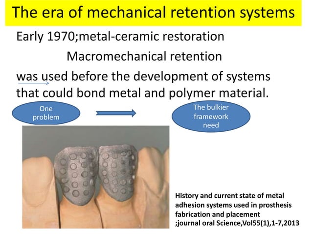 Metal primer ,silane,zirconia primer Reviews | PPT