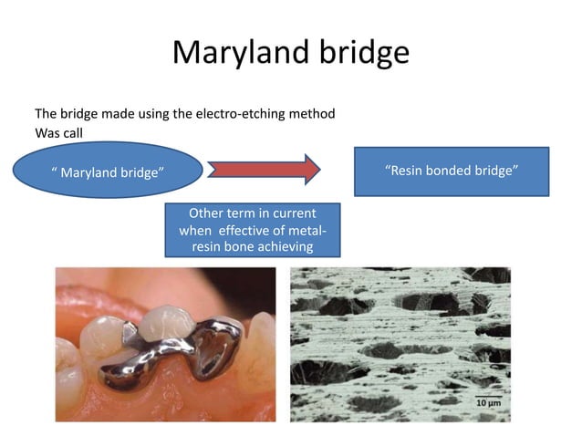 Metal primer ,silane,zirconia primer Reviews | PPT