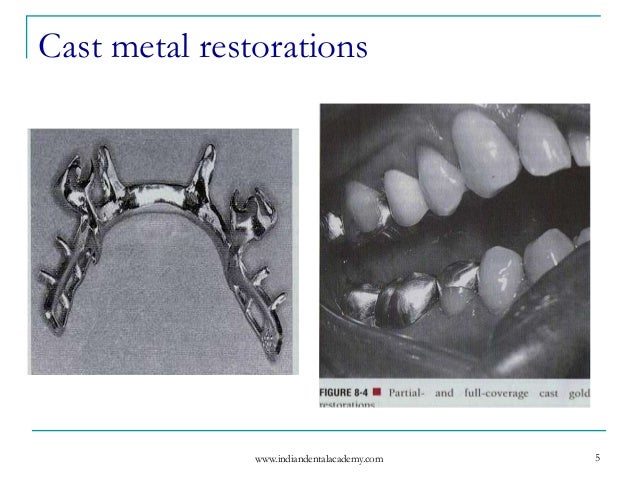Metals in dentistry /certified fixed orthodontic courses by Indian de…