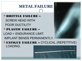 Metals in orthopaedics | PPT