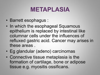 Metaplasia | PPTX