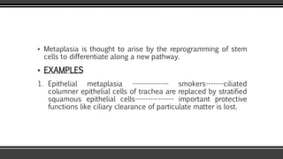 Metaplasia (1) | PPT | Free Download