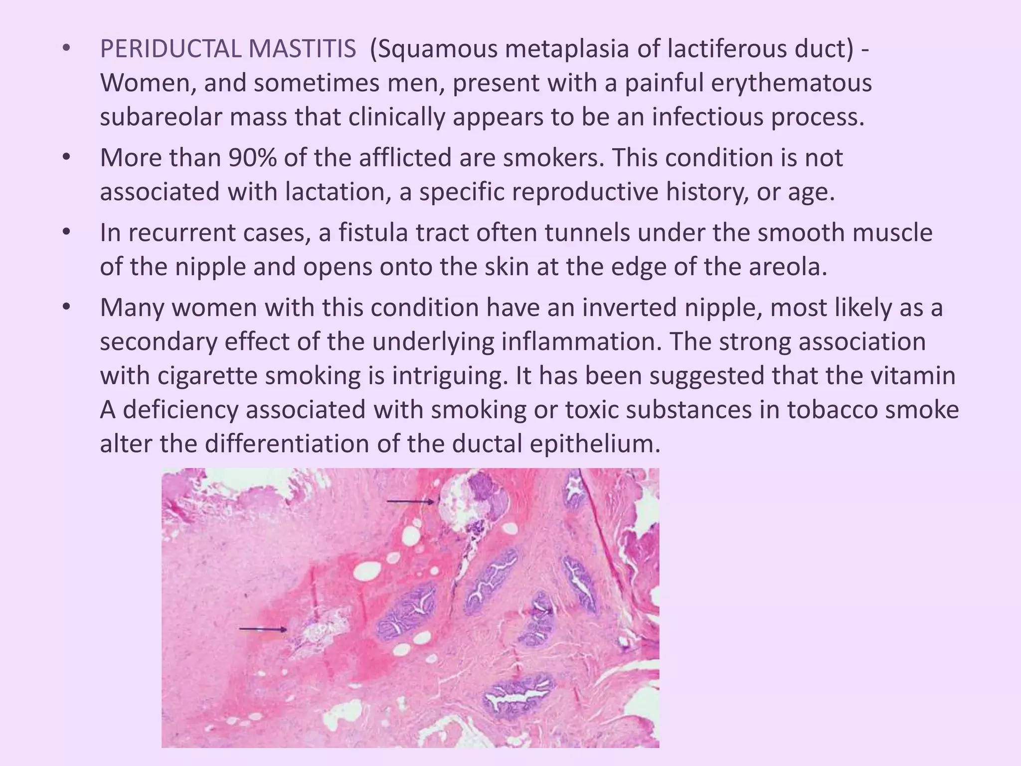 Metaplasia & Dysplasia | PPTX