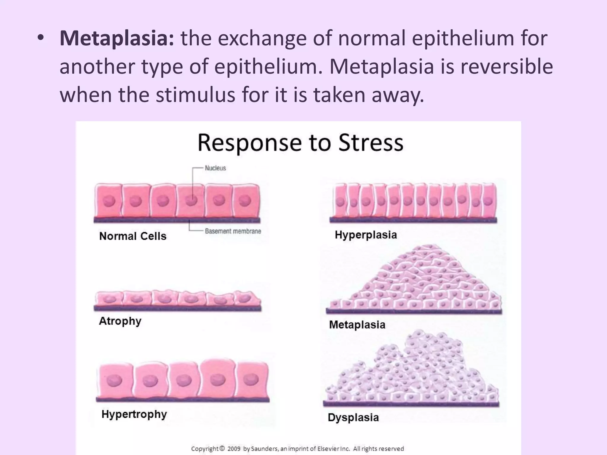 Metaplasia & Dysplasia | PPTX