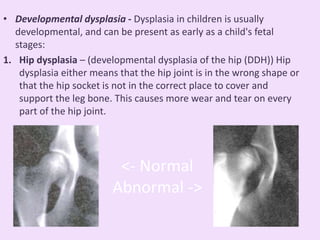 Metaplasia & Dysplasia | PPTX
