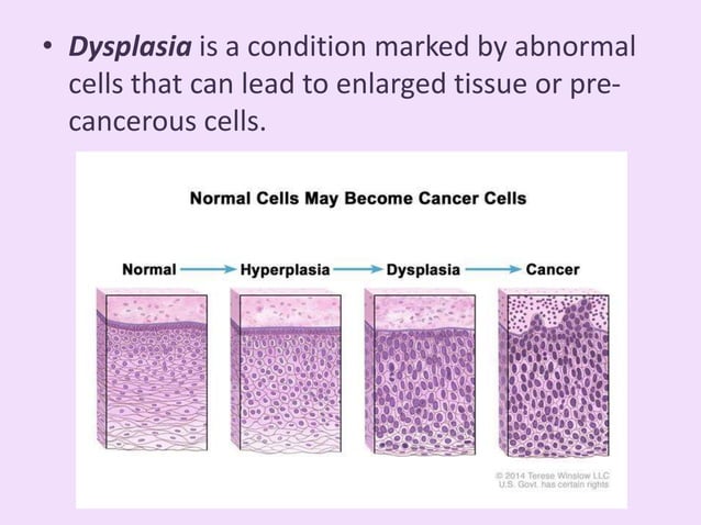 Metaplasia & Dysplasia