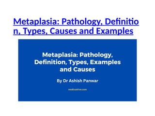 Metaplasia Pathology, Definition, Types, Causes and Examples | PPTX