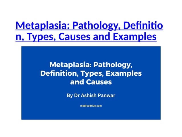 Metaplasia Pathology, Definition, Types, Causes and Examples | PPTX