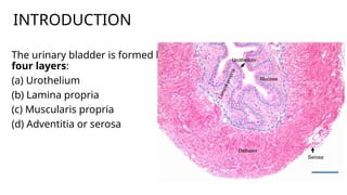 METAPLASTIC LESIONS IN BLADDER_1.pptx ppt | PPTX