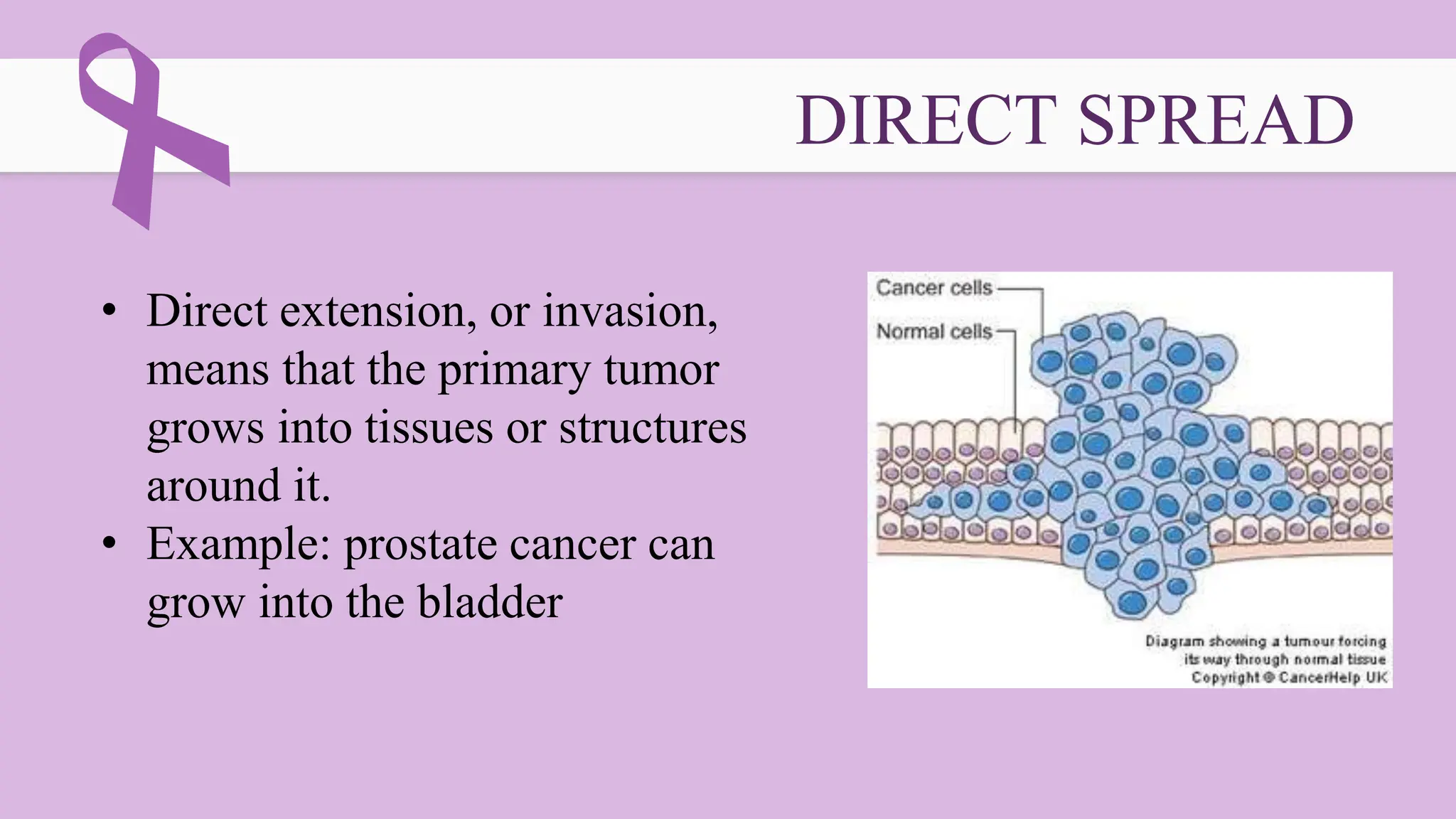 METASIS OF MALIGNANT TUMOR.pptx