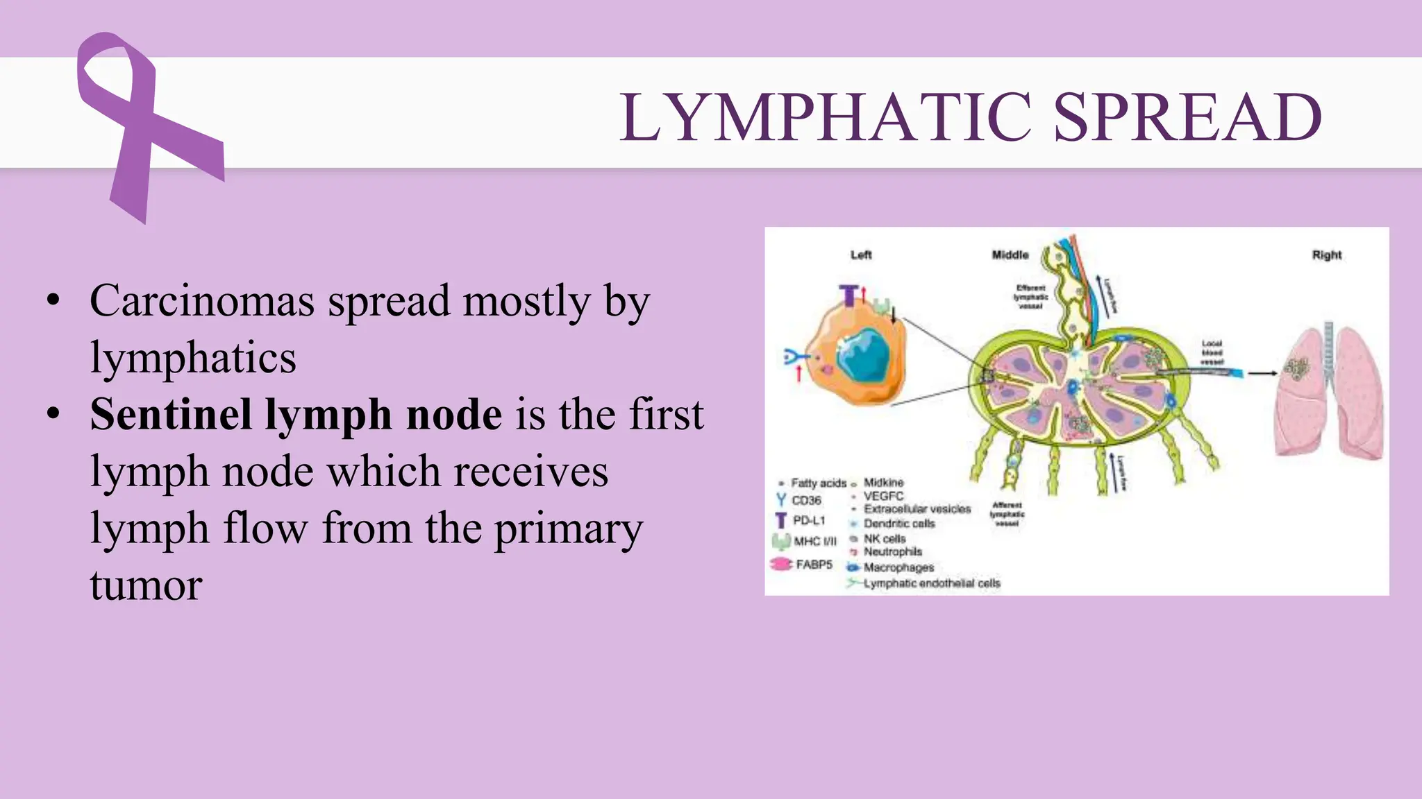 METASIS OF MALIGNANT TUMOR.pptx