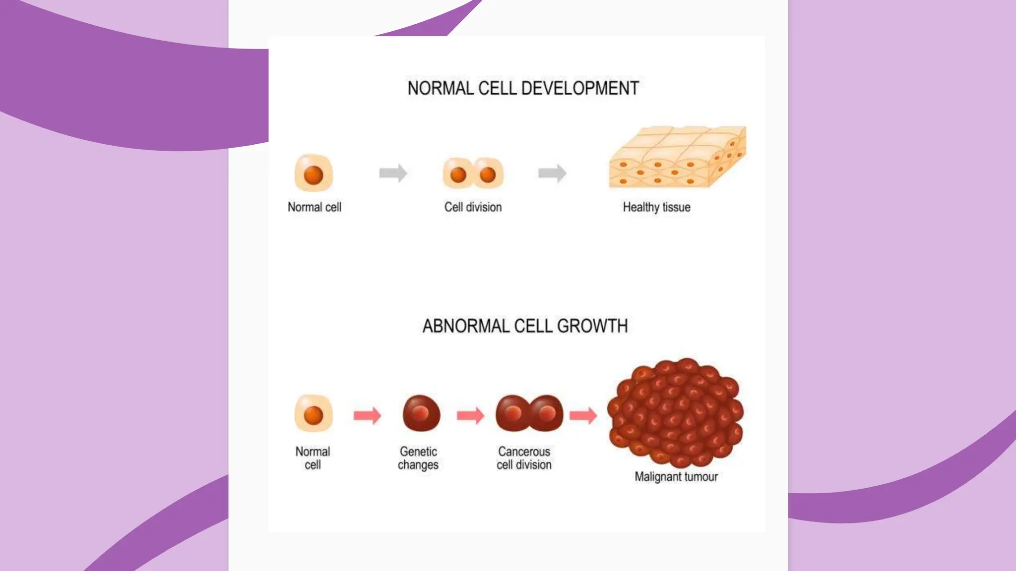 METASIS OF MALIGNANT TUMOR.pptx
