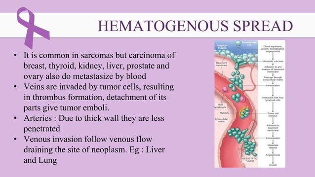 METASIS OF MALIGNANT TUMOR.pptx