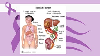 METASIS OF MALIGNANT TUMOR.pptx