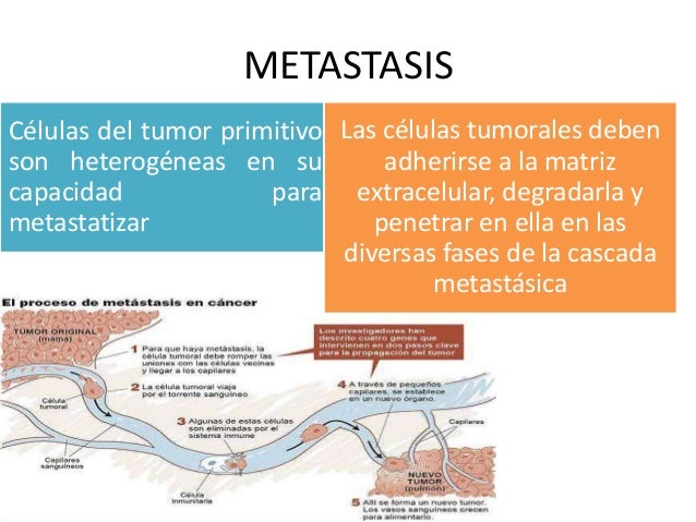 Metastasis