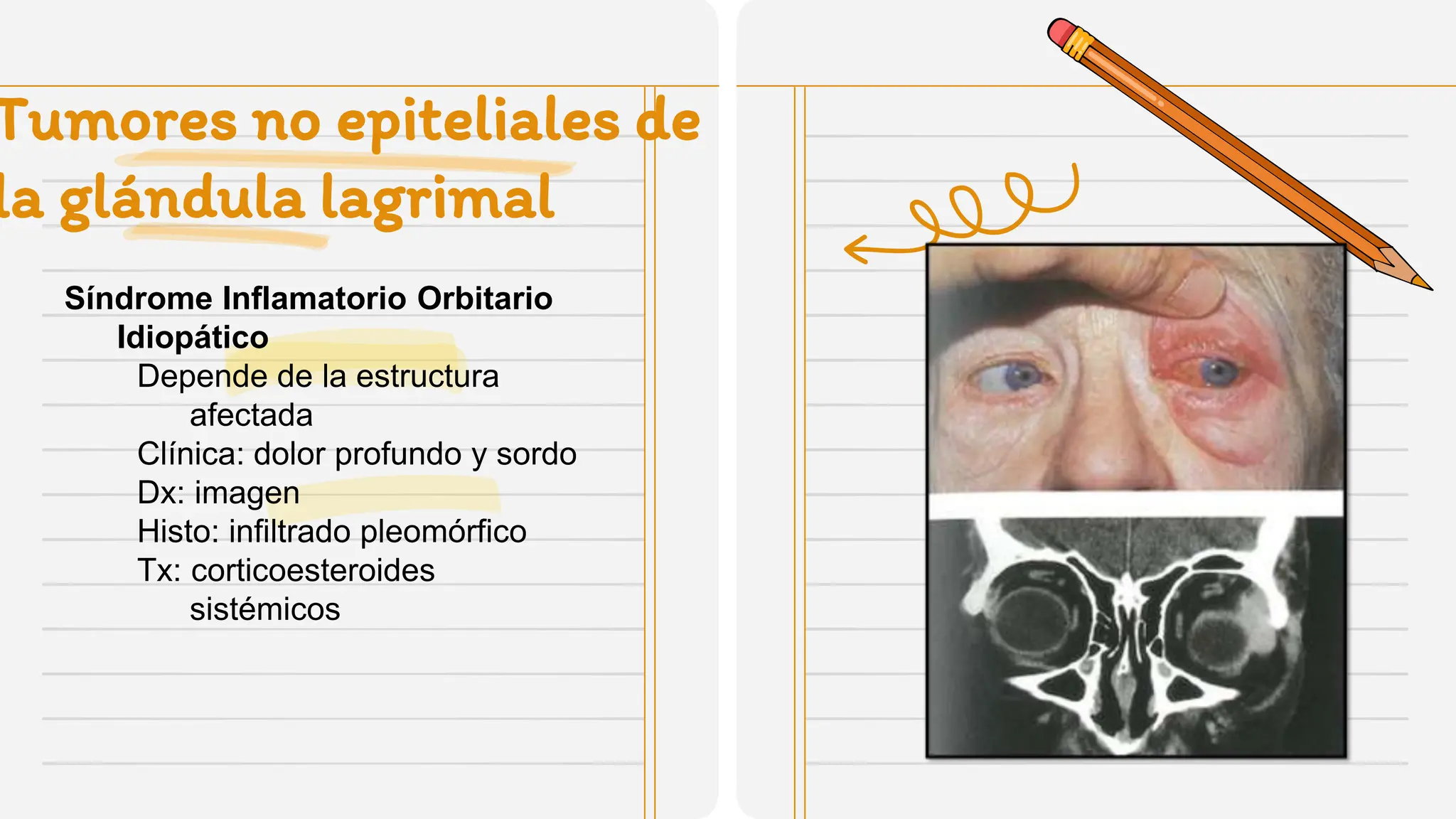 Tumores orbitarios malignos | PPT